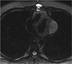 Cardiology Case 1 | NucsRadiology.com